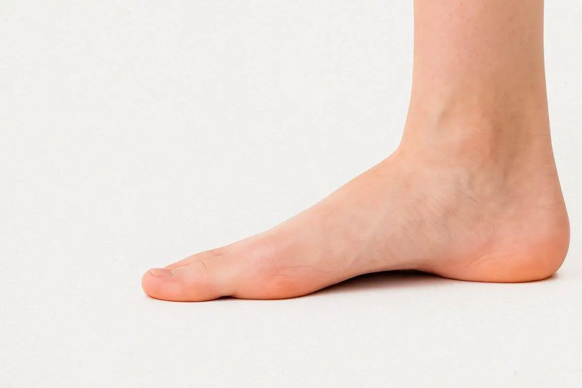 Ultimate Guide to Flat Feet or Fallen Arches - Best Walking Feet